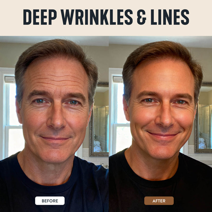 Forge Wrinkle Defense Tallow Balm – Forge Men